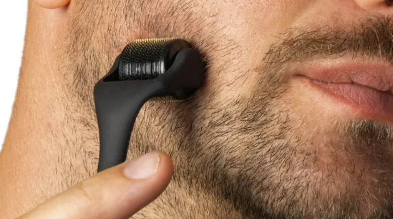 The Ultimate Guide to Owning a Derma Roller | Xdermaroller