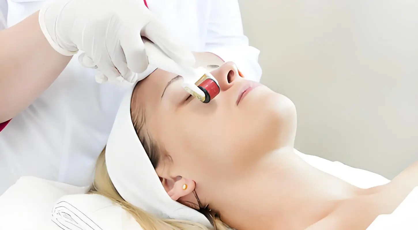 Derma Roller Healing Process: Is There Any Side Effects? | Xdermaroller