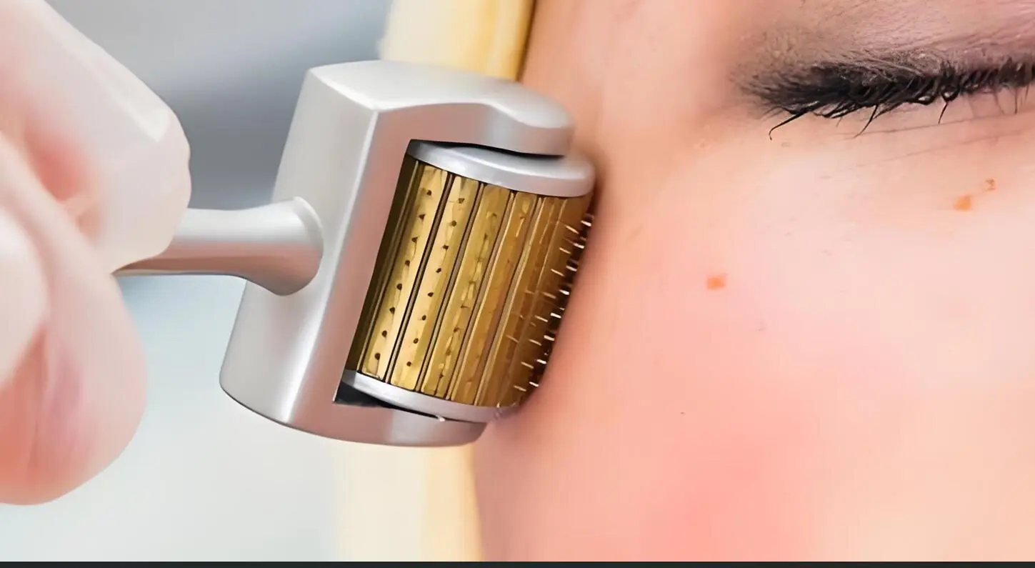 Medical Grade Derma Rollers: What Is The Difference | Xdermaroller
