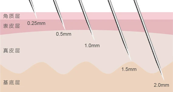 How to Choose The Right Derma Roller Needle Sizes | Xdermaroller