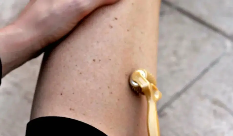 How to Use Derma Roller on Inner Thighs | Xdermaroller