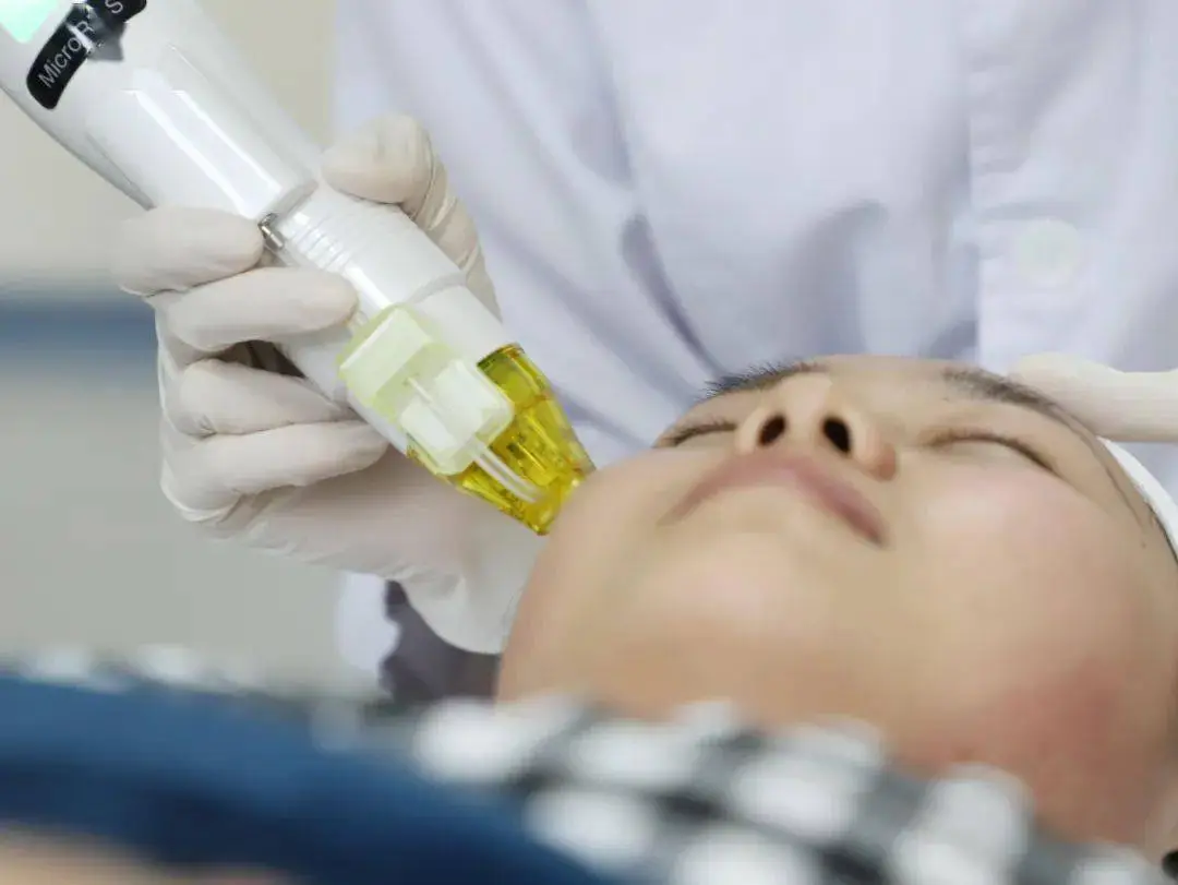 Microneedling vs Derma Rolling: How to Choose? | Xdermaroller