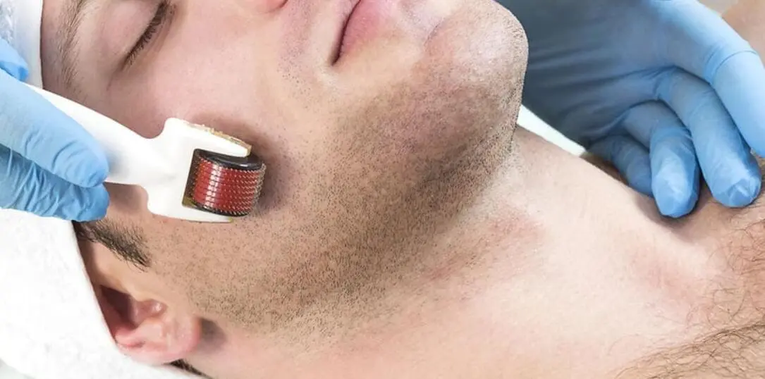 Ideal Beard Derma Roller Usage Frequency Guide | Xdermaroller