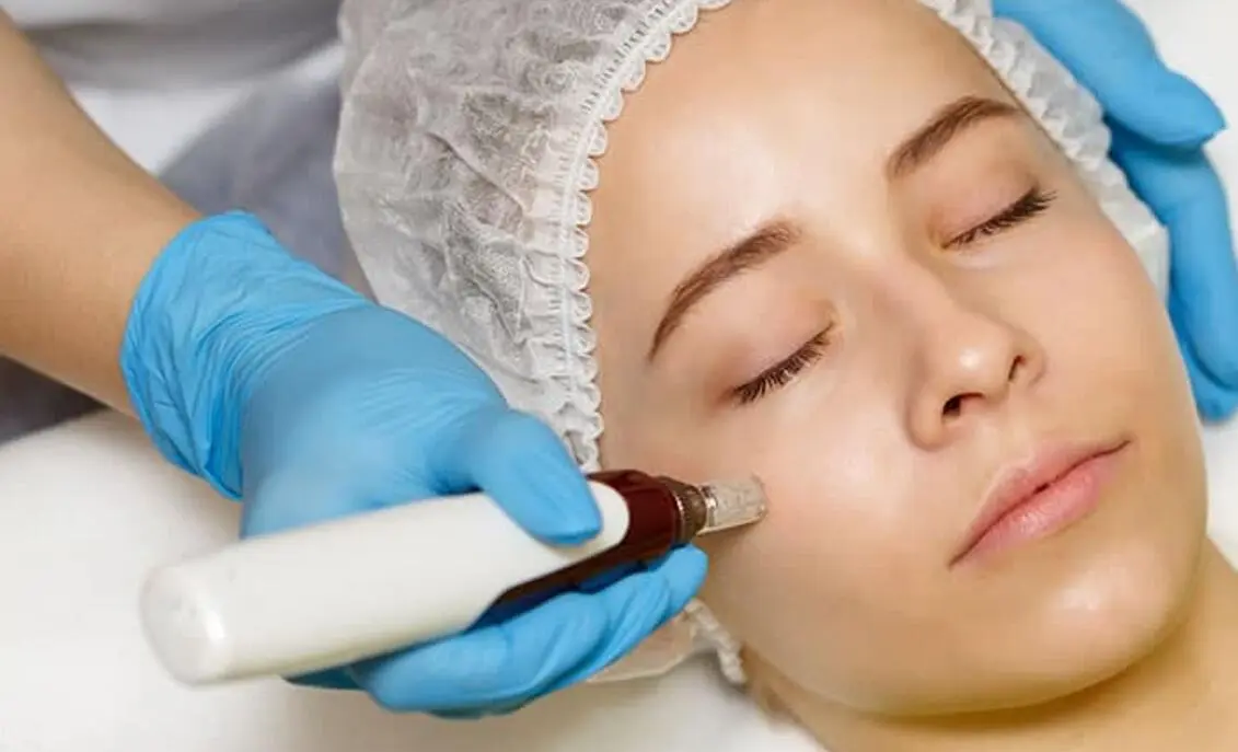 Derma Roller Therapy Explained: Benefits, Uses & Tips | Xdermaroller