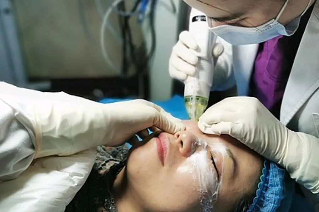 The Benefits of Microneedling Under Eyes | Xdermaroller