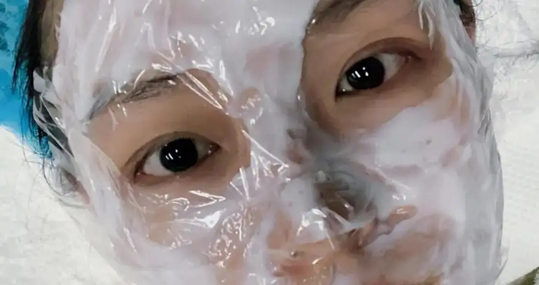 How to Take Care of Your Skin After Derma Rolling | Xdermaroller
