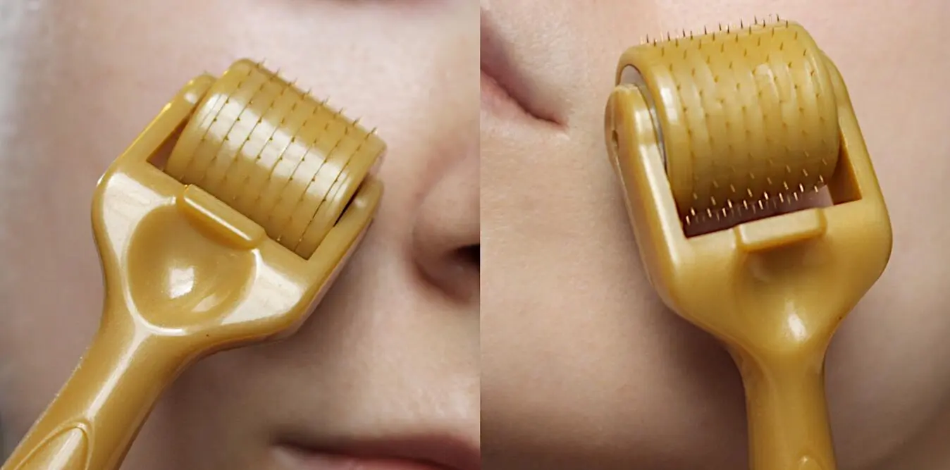 The History of Derma Rollers: From Invention to Popularity | Xdermaroller